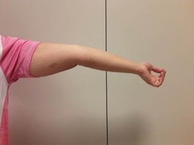 DEPARTAMENTO DE FISIOTERAPIA - Test de Beighton - Universidad de Málaga